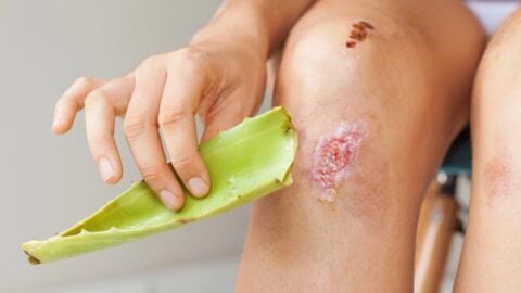 12 Reasons Aloe Vera Is a Wellness Must-Have